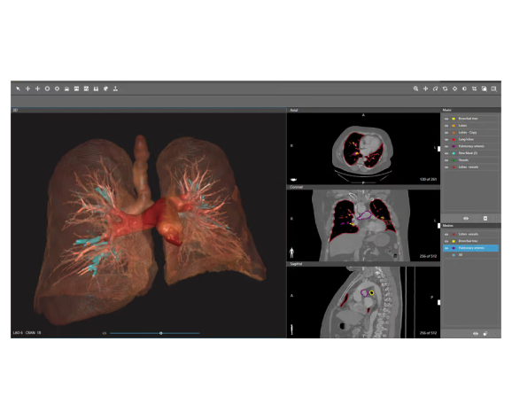 3D Printers - Rapid Scan 3D